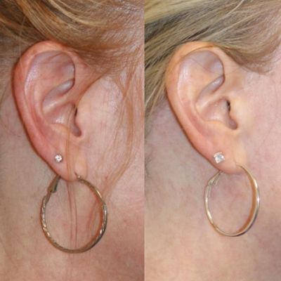 EVAN RANSOM, MD - Updated December 2025 - 126 Photos & 241 Reviews ...