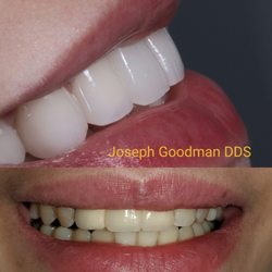 JOSEPH GOODMAN, DDS, DMD - 97 Photos & 124 Reviews - 241 1/2 S Beverly ...