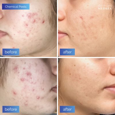 DERMANI MEDSPA - Updated January 2026 - 78 Photos & 57 Reviews - 6955 ...