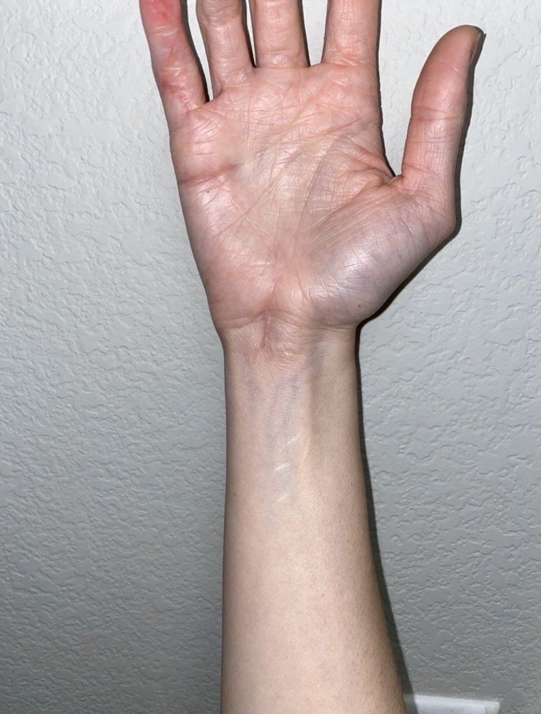 THE MINIMALLY INVASIVE HAND INSTITUTE - 51 Photos & 68 Reviews - 9080 W ...