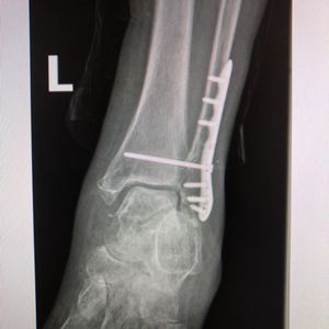 RICHARD D FERKEL, MD - Updated April 2025 - 17 Reviews - 6815 Noble Ave ...