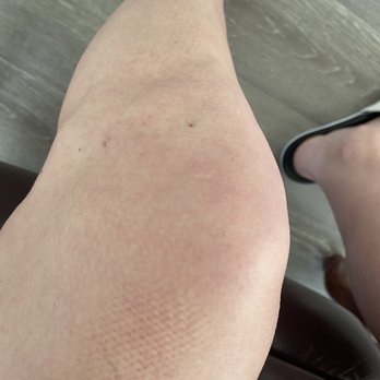 SKIN CANCER & COSMETIC SURGERY CENTER OF NJ - Updated December 2025 ...