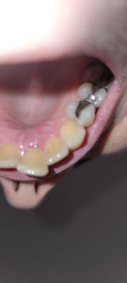 FIRST STREET DENTAL GROUP - Updated May 2026 - 38 Photos & 88 Reviews ...