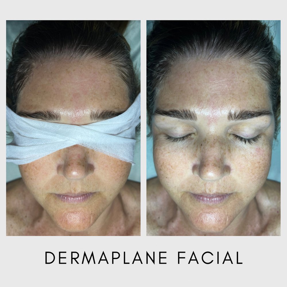 NIKKI MCNAB AESTHETICS - Updated November 2025 - 13 Photos - 4751 Main ...