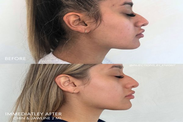 MUSE MED SPA - Updated November 2025 - 10660 Randolph St, Crown Point ...