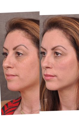 BEN TALEI, MD | 195 Photos & 189 Reviews | 465 N Roxbury Dr, Beverly ...