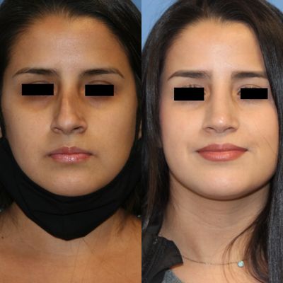 EVAN RANSOM, MD - Updated December 2025 - 126 Photos & 241 Reviews ...