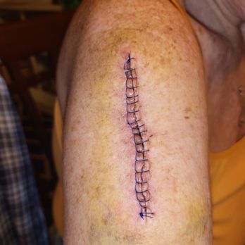 MARTIN E SALM, MD - Updated October 2025 - 51 Reviews - 276 Kingsbury ...