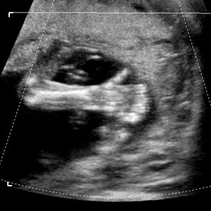 WASATCH IMAGING - Updated May 2025 - 9844 S 1300th E, Sandy, Utah ...