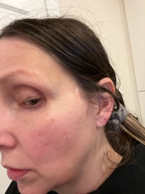 MICHAEL J DUFFY ,MD- COSMETIC & RECONSTRUCTIVE SURGERY CENTER - Updated ...