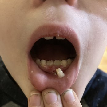 ASHISH PARAMESWARAN, DMD - PIONEER VALLEY PEDIATRIC DENTISTRY - Updated ...