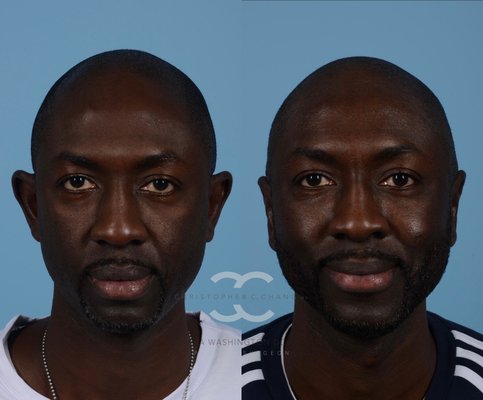 CONGRESSIONAL PLASTIC SURGERY | CHRISTOPHER C. CHANG, M.D - Updated ...