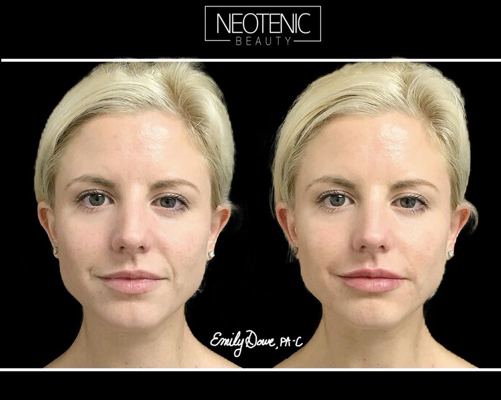 NATURAL INJECTOR - Updated July 2025 - 59 Photos - 1601 North Pacific ...