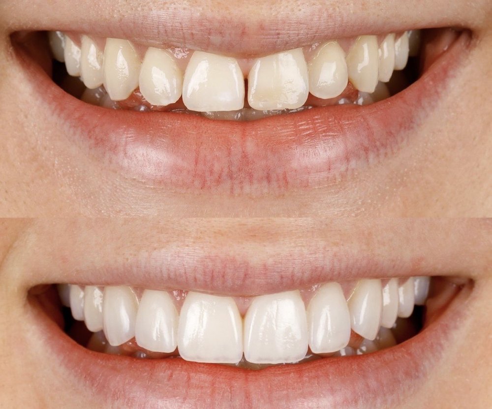 YANAGI DENTAL IRVINE BY DR. GLENN YANAGI - Updated October 2025 - 37 ...