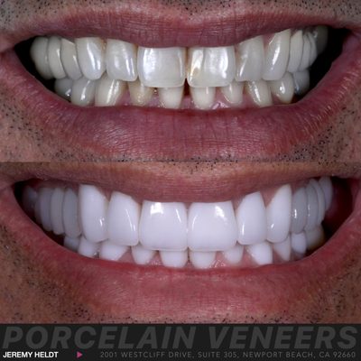 JEREMY HELDT, DDS - Updated March 2025 - 222 Photos & 105 Reviews ...