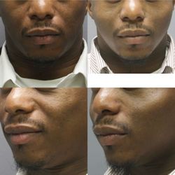 DAVINCI PLASTIC SURGERY - 39 Photos & 28 Reviews - 3301 New Mexico Ave ...