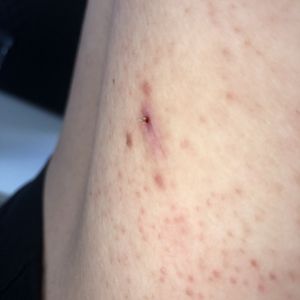 DERMASPAMED - Updated December 2025 - 21 Reviews - 340 James Way, Pismo ...