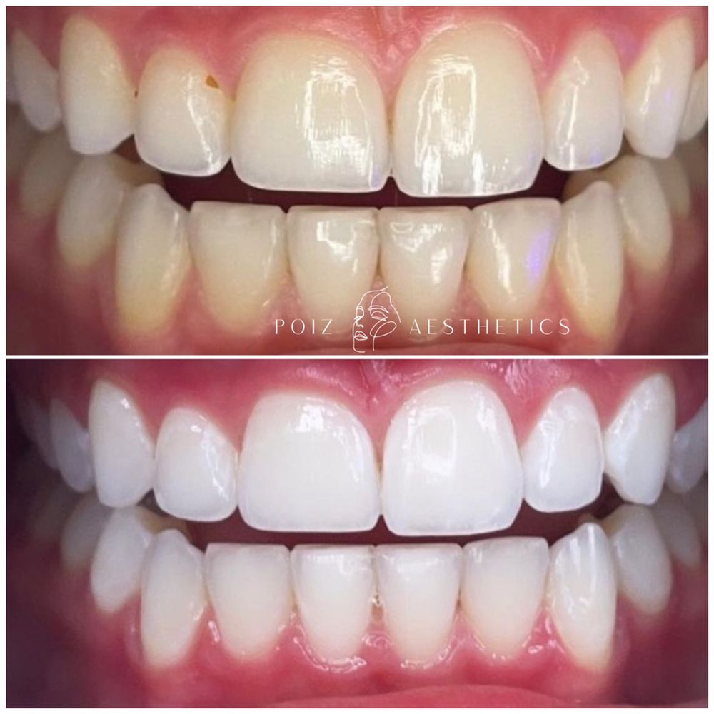 POIZ AESTHETICS - Updated April 2026 - Request an Appointment - 17 ...