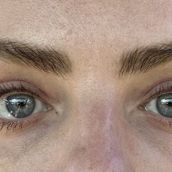 MEHRYAR RAY TABAN MD - OCULOPLASTIC SURGEON - Updated January 2025 ...