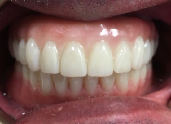 EL DORADO FAMILY DENTAL - Updated January 2026 - 25 Photos & 44 Reviews ...