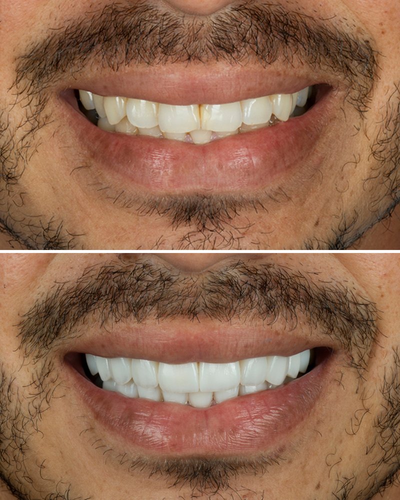 BERREY FAMILY DENTISTRY - Updated April 2026 - 26 Photos - 9115 SW 87th ...