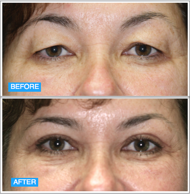 WEISS COSMETIC & LASER PROCEDURES - Updated September 2025 - 63 Photos ...