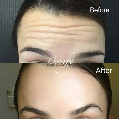 DERMFX - Updated August 2025 - 210 Photos & 362 Reviews - 2430 West ...