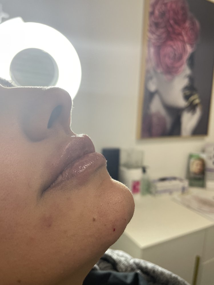 BEYOND AESTHETICS MEDSPA - Updated March 2026 - 19 Photos - 1511 Treat ...