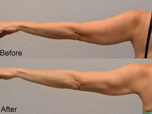 VERITAS PLASTIC SURGERY - VIVIAN TING, MD - Updated January 2026 - 38 ...