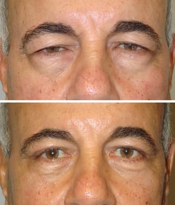 MEHRYAR RAY TABAN MD - OCULOPLASTIC SURGEON - Updated December 2025 ...