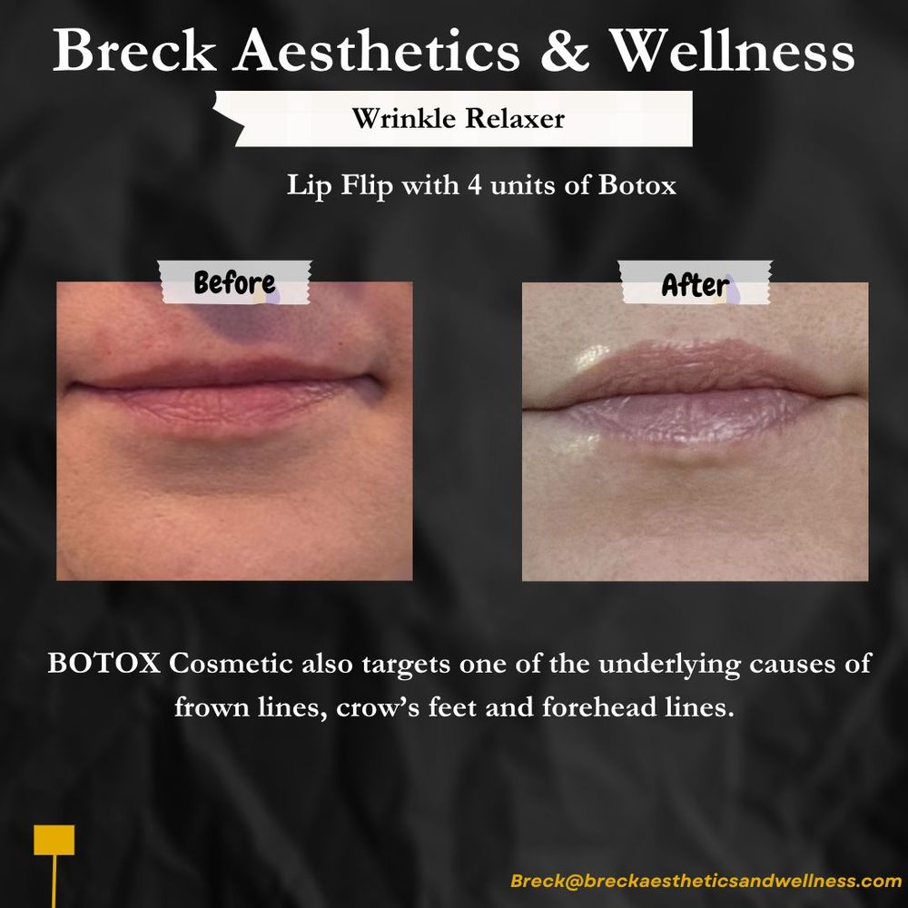 BRECK AESTHETICS & WELLNESS - Updated June 2025 - 26 Photos - 29900 S ...