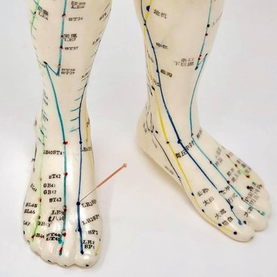 KIND ACUPUNCTURE - CARING HOLISTIC MEDICINE - Updated July 2025 - 44 ...