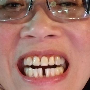 TITUS TANG, DDS MAGD - 84 Photos & 414 Reviews - 59 B Serramonte Ctr ...