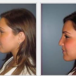 ADAM J RUBINSTEIN, MD FACS - 23 Photos & 51 Reviews - Cosmetic Surgeons ...