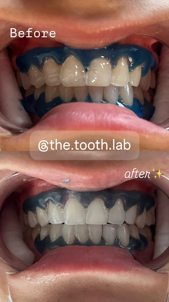 THE TOOTH LAB - Updated April 2025 - Request an Appointment - 2302 W ...