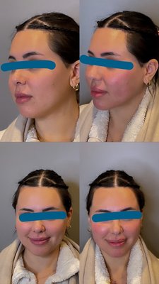 RE-NU AESTHETICS - Updated August 2024 - 12 Reviews - 2923 Sunset Blvd, Los Angeles, California ...