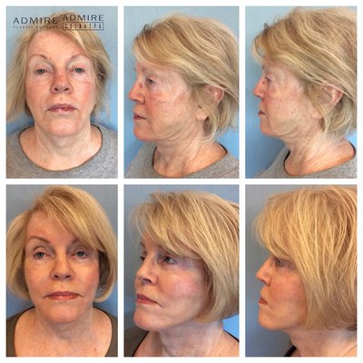 AdmireMD Plastic Surgery + Skin Clinic - Updated May 2026 - 89 Photos ...
