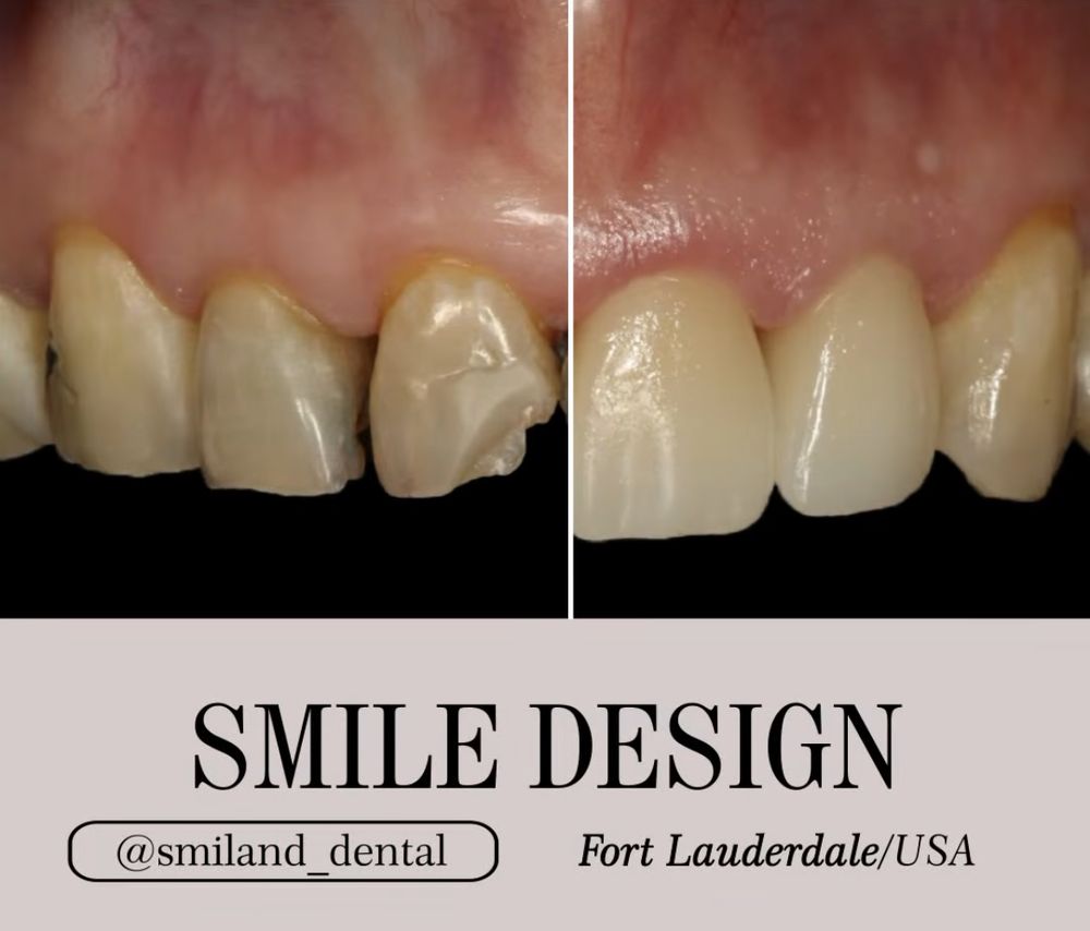 SMILAND DENTAL FORT LAUDERDALE - Updated May 2026 - 2322 E Oakland Park ...