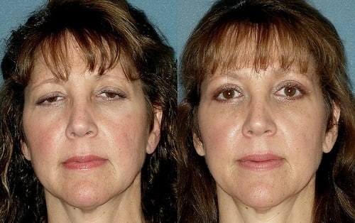 ARIZONA EYE INSTITUTE & COSMETIC LASER CENTER - Updated September 2024 ...