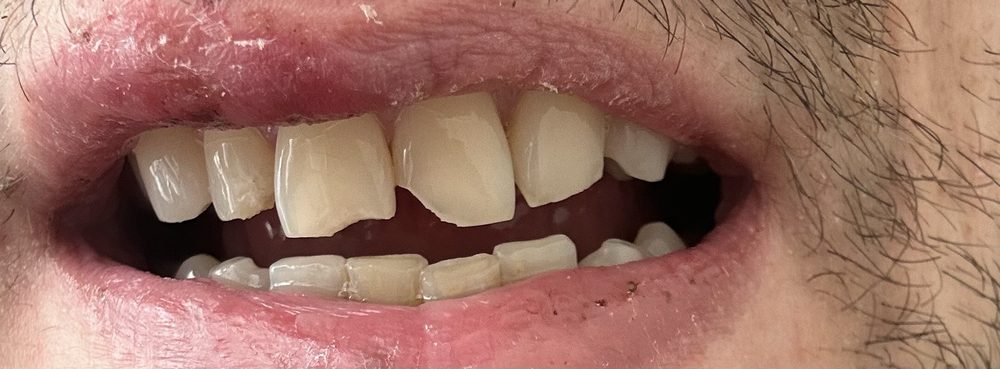 COMFORT DENTAL - DOWNTOWN DENVER - Updated October 2025 - 14 Photos ...