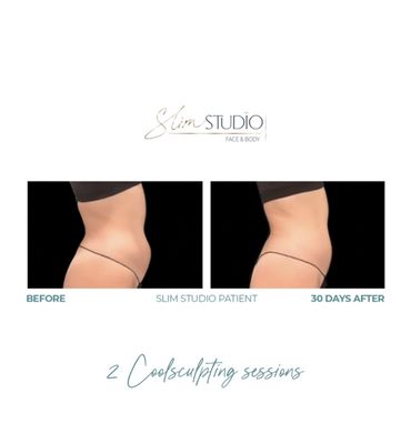 SLIM STUDIO FACE & BODY - Updated January 2026 - 121 Photos & 22 ...