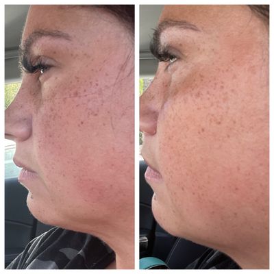 LILLY BEAUTY MEDICAL SPA - Updated November 2025 - 36 Photos & 85 ...