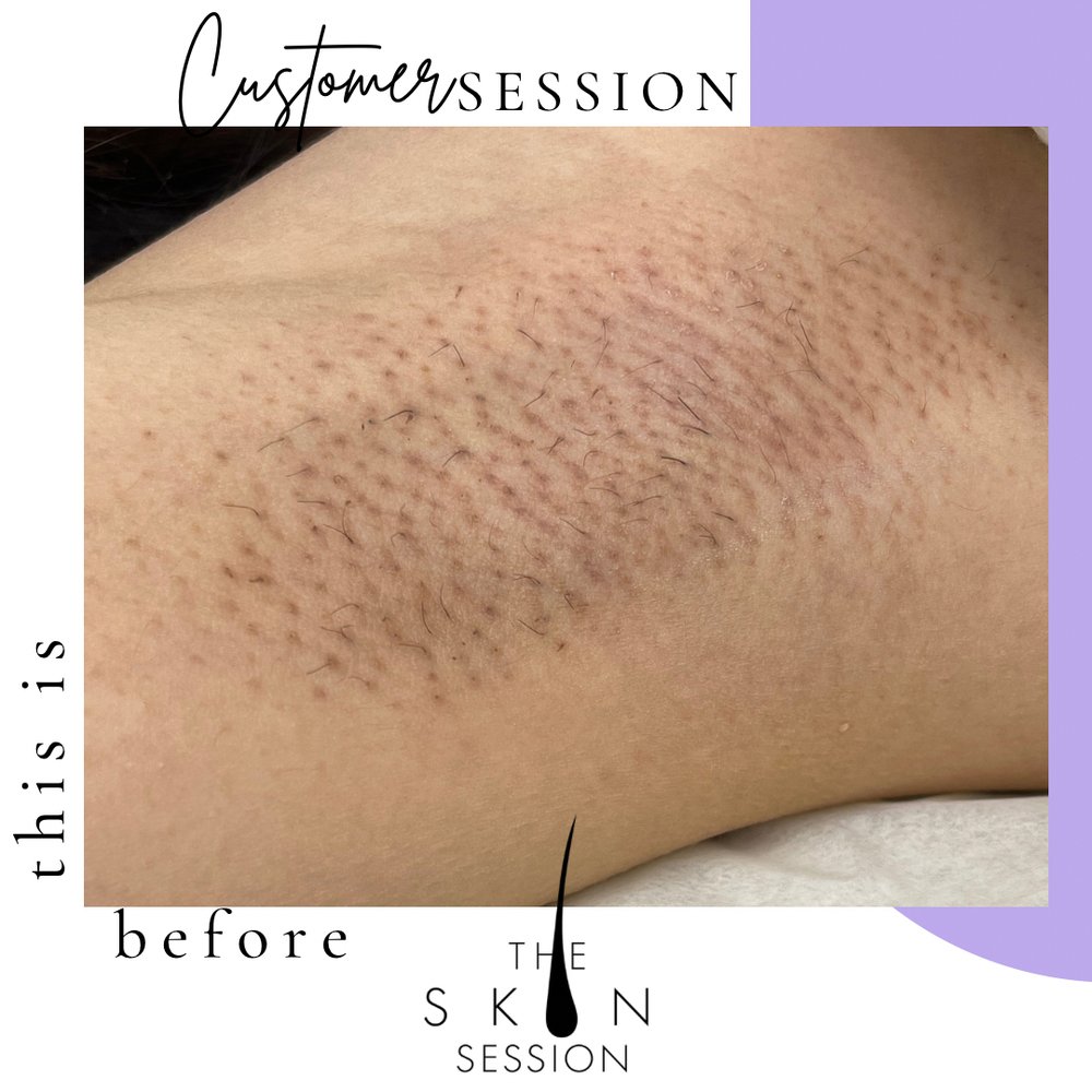 THE SKIN SESSION - Updated October 2025 - 13 Photos - 1500 Peachtree ...