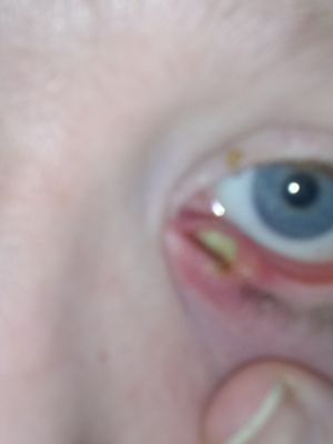 UNIVERSITY HOSPITALS TRIPOINT MEDICAL CENTER - Updated December 2025 ...