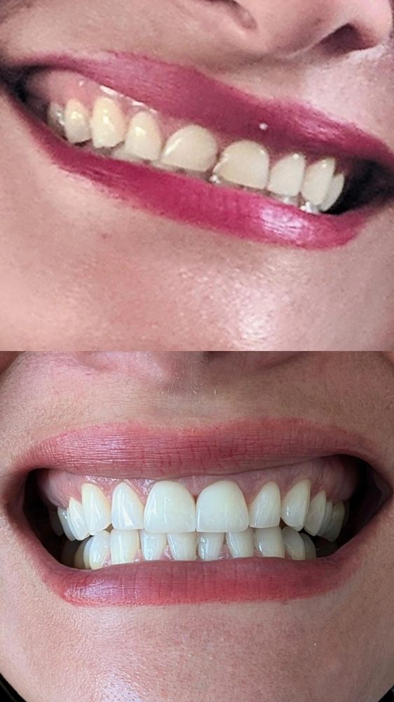 ZAK DENTAL - NORTH PARK - Updated August 2024 - 72 Reviews - 4167 Ohio ...