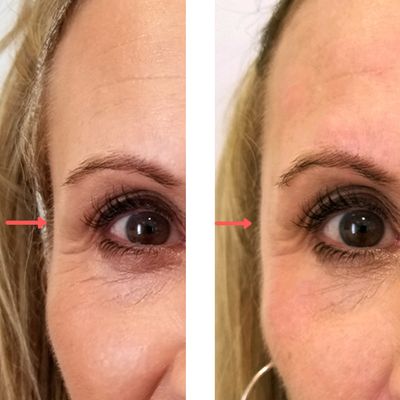 STUART H KAPLAN, MD - MEDICAL & COSMETIC DERMATOLOGIST - Updated ...