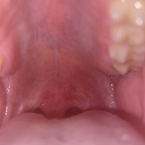 PENTUCKET MEDICAL: EXPRESSCARE RIVERWALK - Updated September 2025 - 29 ...