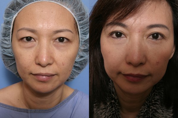 VIP PLASTIC SURGERY - Updated August 2025 - 112 Photos & 72 Reviews ...