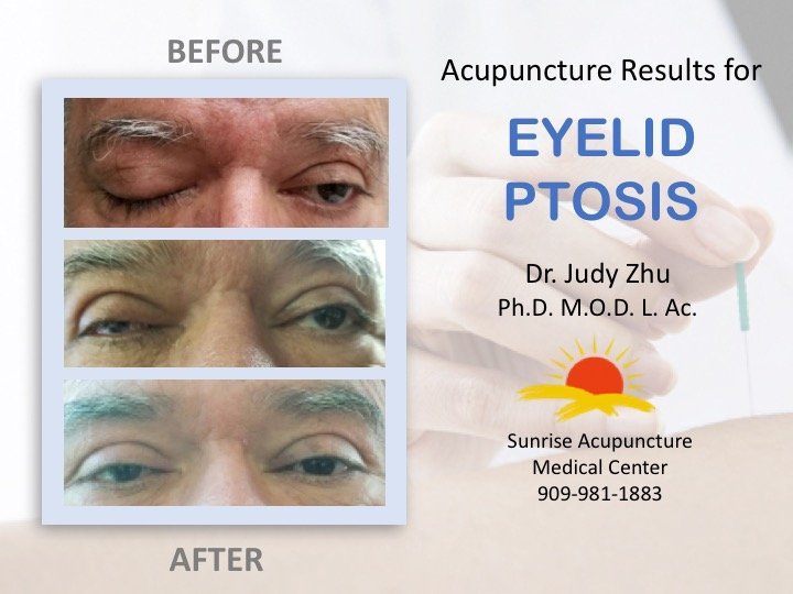 SUNRISE ACUPUNCTURE MEDICAL CENTER - Updated June 2025 - 11 Photos & 20 ...