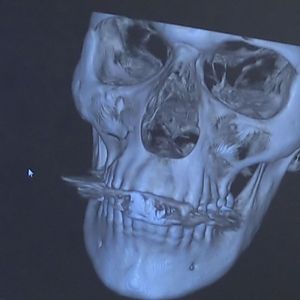 ENCOMPASS HEALTH REHABILITATION HOSPITAL OF MIAMI - Updated December ...